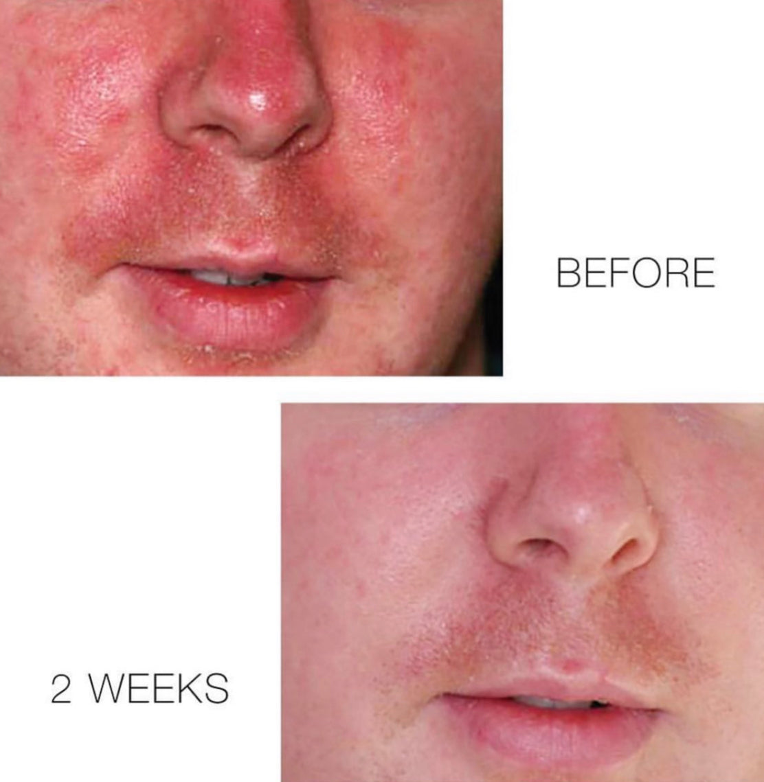 iS Clinical - Pro - Heal Serum Advance 30ml | Gisborne Skin Clinic