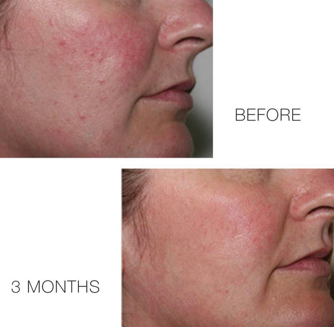 iS Clinical - Pro - Heal Serum Advance 30ml | Gisborne Skin Clinic